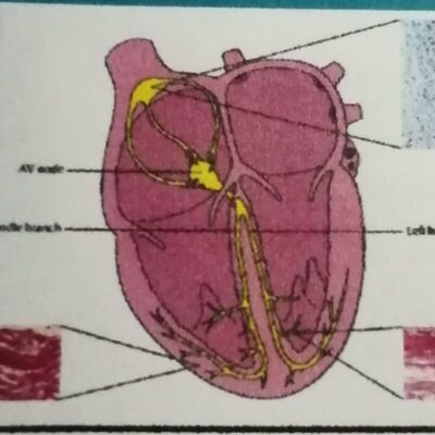 Adult congenital heart disease: สาระความรู้