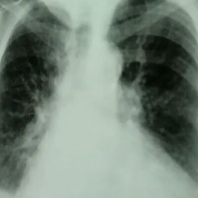 cardiac imagine and common cardiac presentation : สาระความรู้