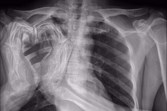 นายเอกแซ่บ! - List A Write