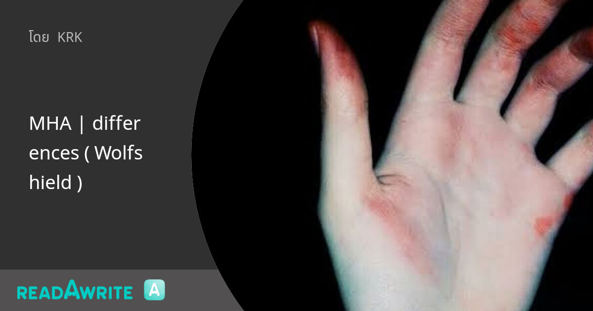 MHA | differences ( Wolfshield ): ฟิค Boy Love (บรรยาย)
